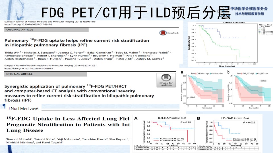 中华医学会核医学分会 讲座 【CSNM继教学组】讲座E12 李原 PET/CT在间质性肺病诊治中应用