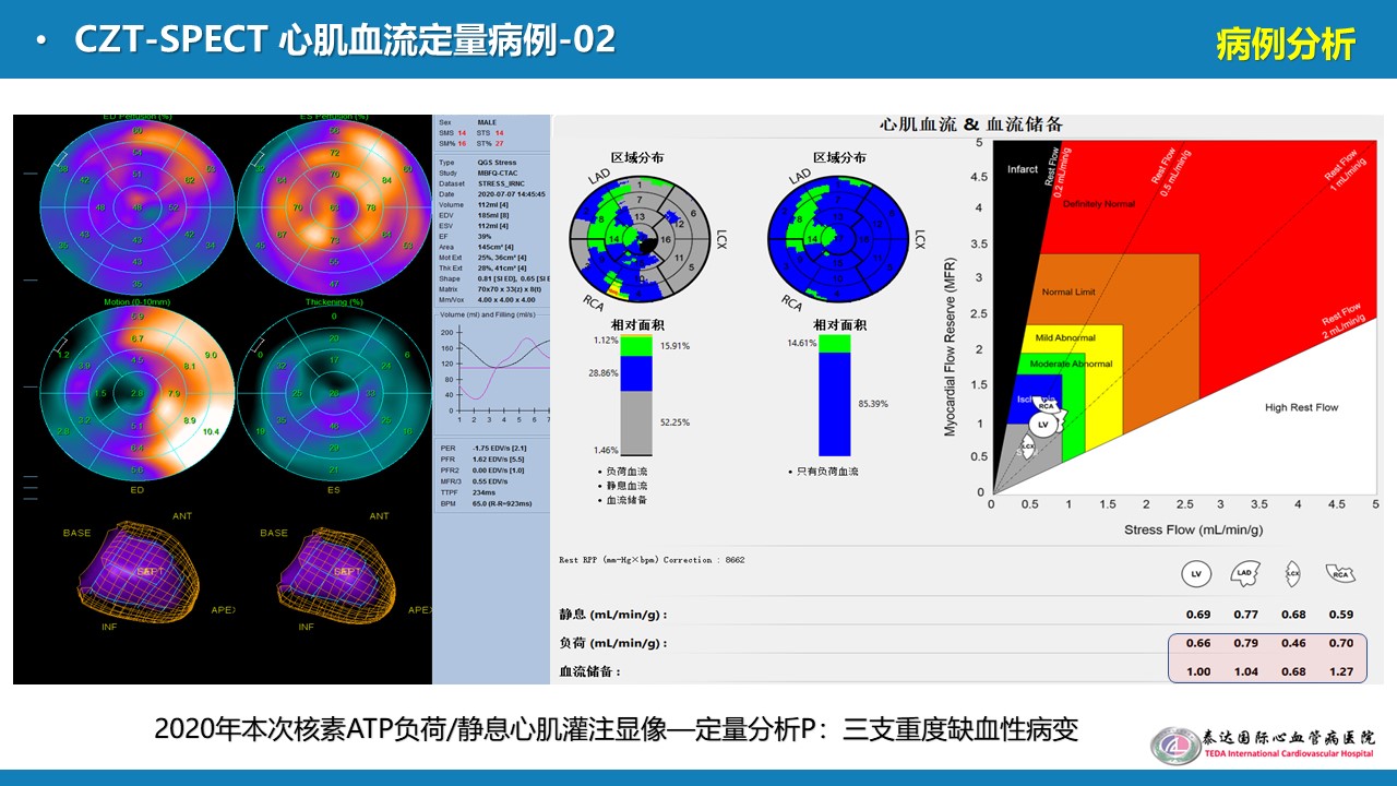 中华医学会核医学分会 核汇园 【核汇园】之（85）- 李剑明教授讲授《CZT心脏SPECT临床研究及进展》