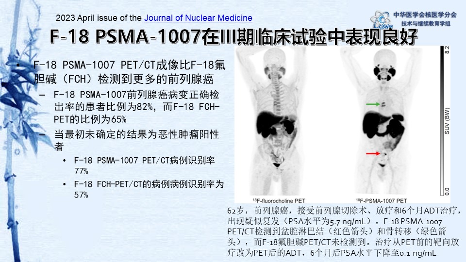 中华医学会核医学分会 讲座 【CSNM继教学组】讲座E2 姚稚明 2023核医学年进展（上）