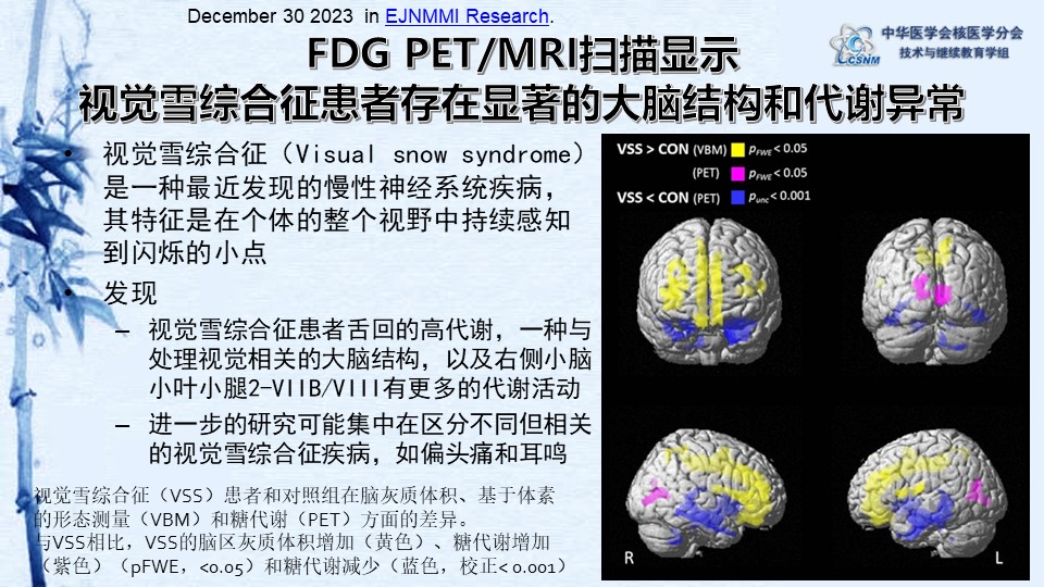 中华医学会核医学分会 讲座 【CSNM继教学组】讲座E2 姚稚明 2023核医学年进展（上）