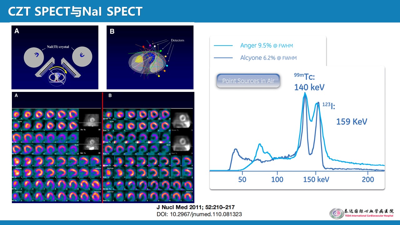 中华医学会核医学分会 核汇园 【核汇园】之（85）- 李剑明教授讲授《CZT心脏SPECT临床研究及进展》